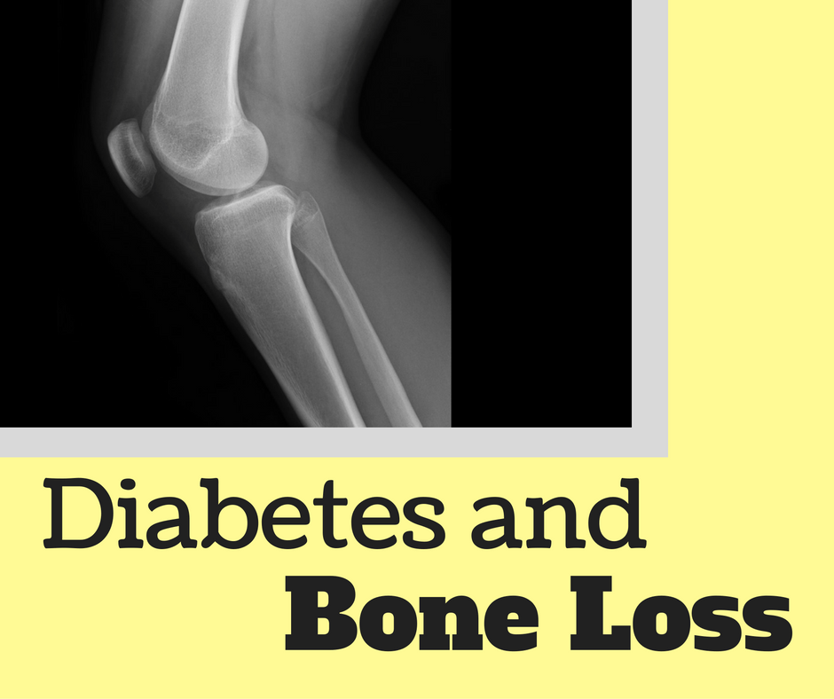 Diabetes And Bone Loss SeniorAdvisor Blog Diabetes And Bone Loss SeniorAdvisor Blog