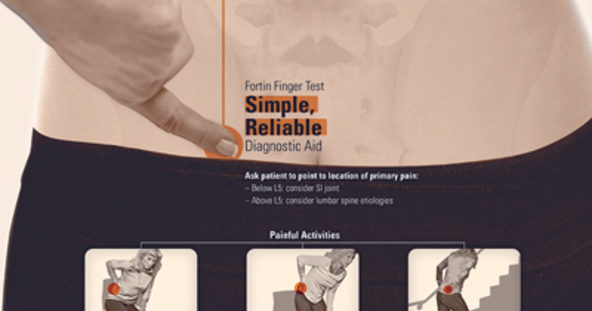 Fortin Finger Test Poster | SI-BONE